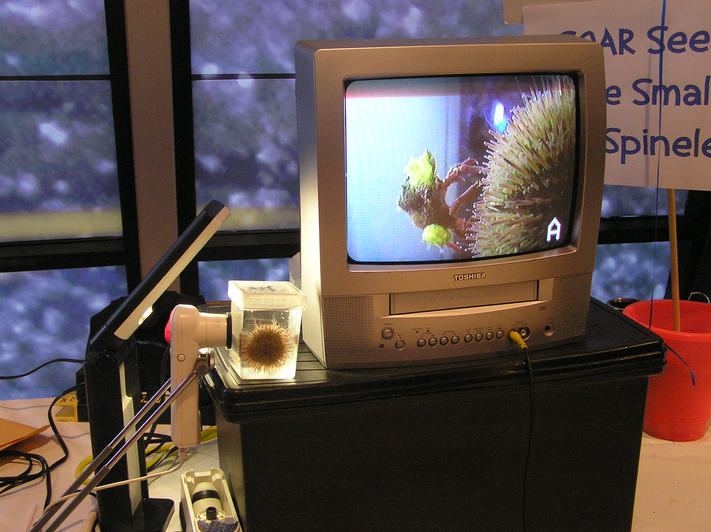 Scope on a Rope | LSU Scope on a Rope